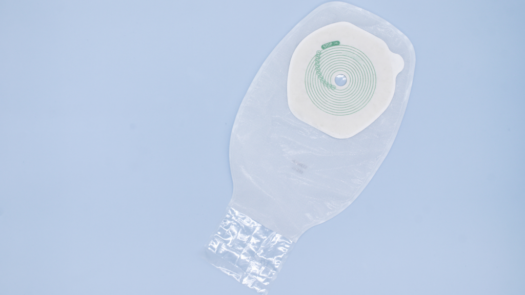 Living with Ostomy and G-Tubes: An Exhaustive Guide to Mastery ...