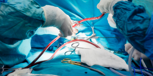 The STEP/Bianchi Procedure: Hope for Short Bowel Syndrome Patients ...